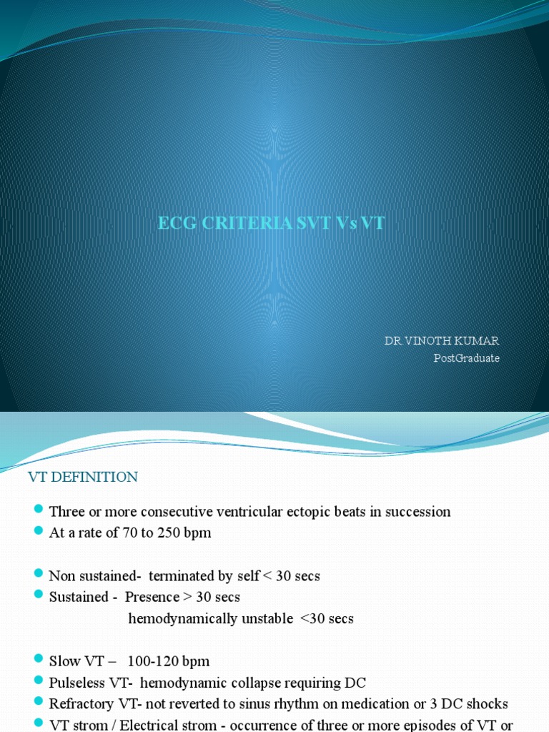 Ecg Criteria SVT Vs VT: DR - Vinoth Kumar Postgraduate | PDF ...