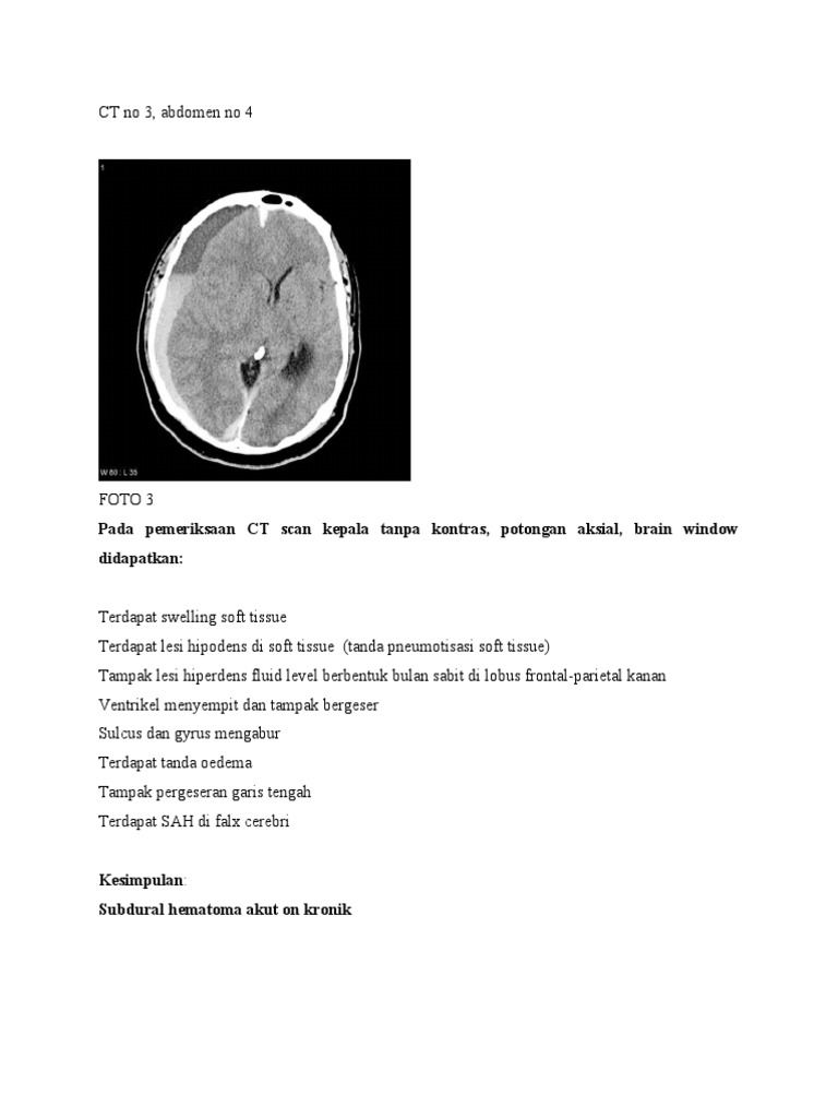 Pada Pemeriksaan CT Scan Kepala Tanpa Kontras, Potongan Aksial, Brain Window Didapatkan | PDF ...
