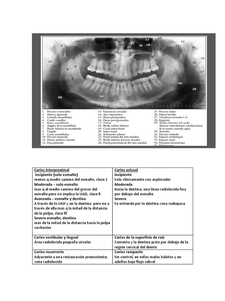 Caries Interproximal Materia | PDF | Especialidades Medicas | Ciencias ...