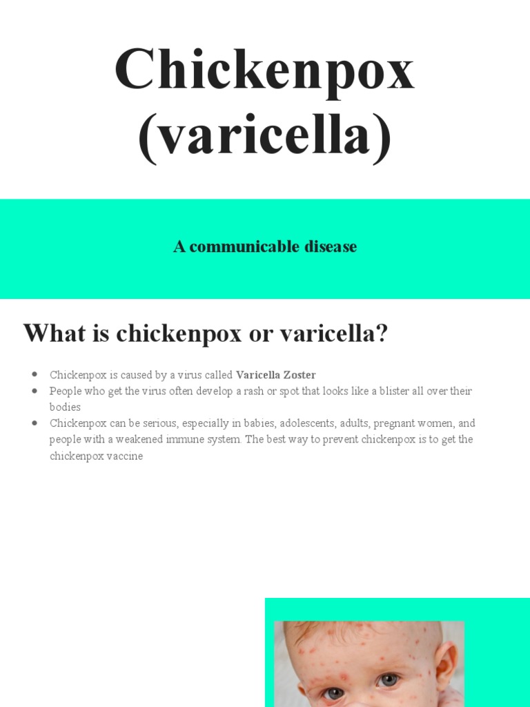 Chickenpox (Varicella) : A Communicable Disease | PDF | Animal Diseases ...