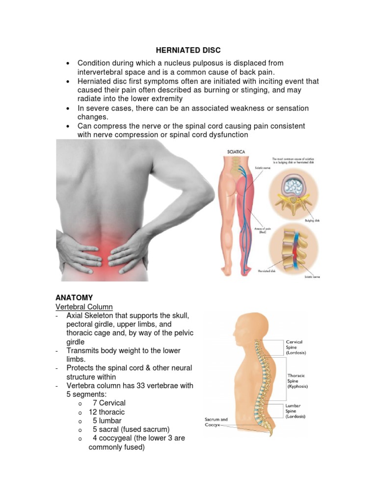 02 IVD Hernia Case Report MedBac&IE | PDF | Vertebra | Vertebral Column