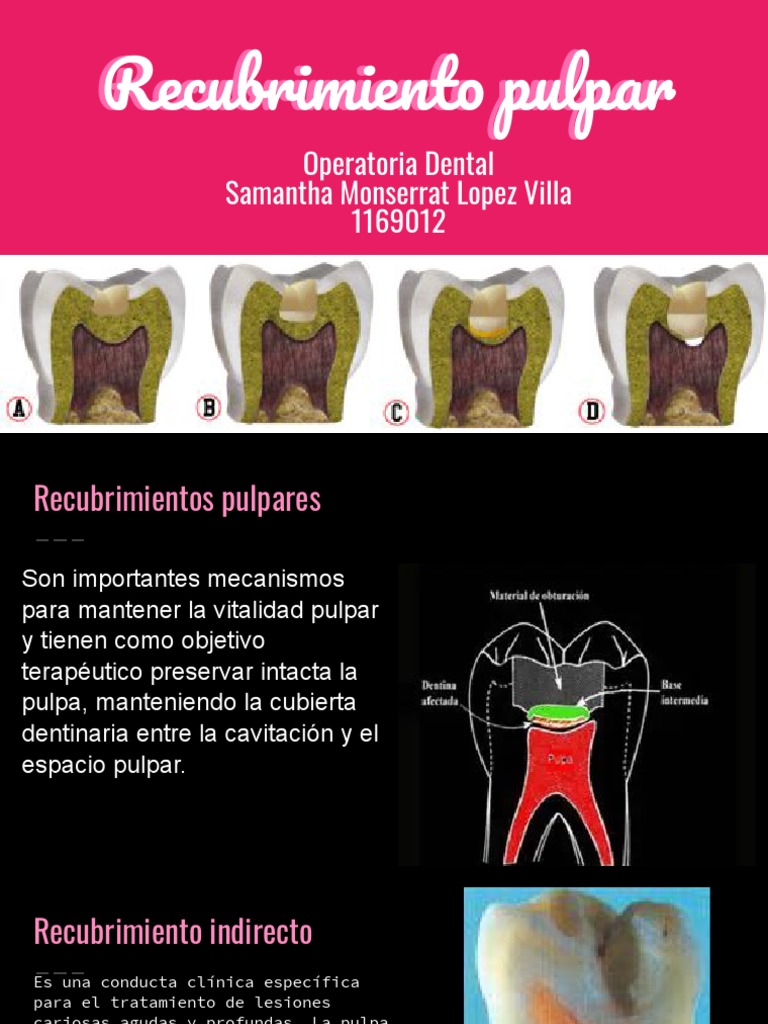 Recubrimientos Pulpares - SM | PDF | Calcio | Dolor