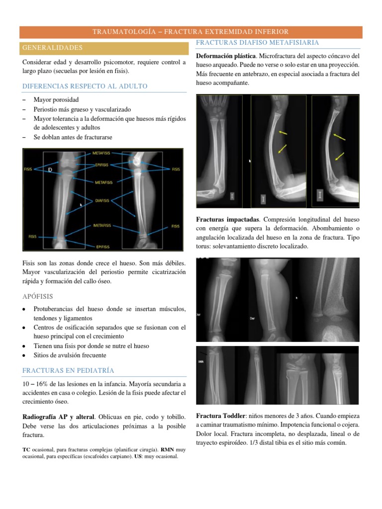 CT02 - Fracturas | PDF | Tobillo | Rodilla
