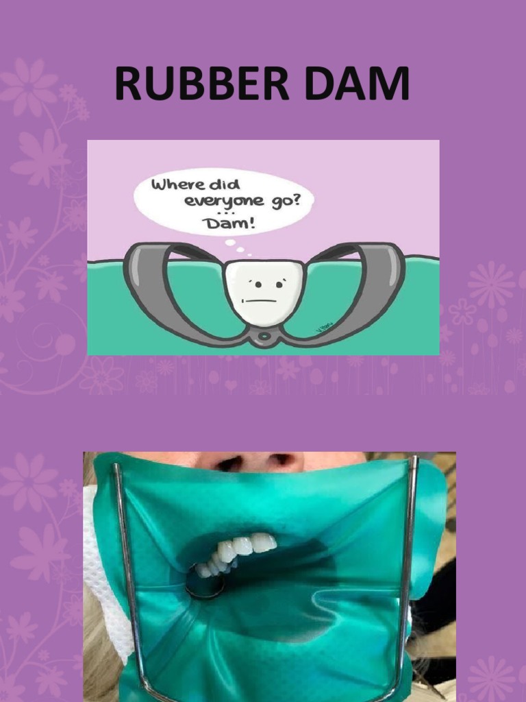 Rubber Dam | PDF | Dentistry | Health Sciences