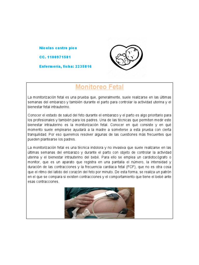 Monitoreo Fetal: Guía y Procedimientos | PDF | Parto | El embarazo
