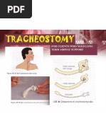 Tracheostomy Tube Sizing Guide | PDF | Clinical Medicine | Equipment