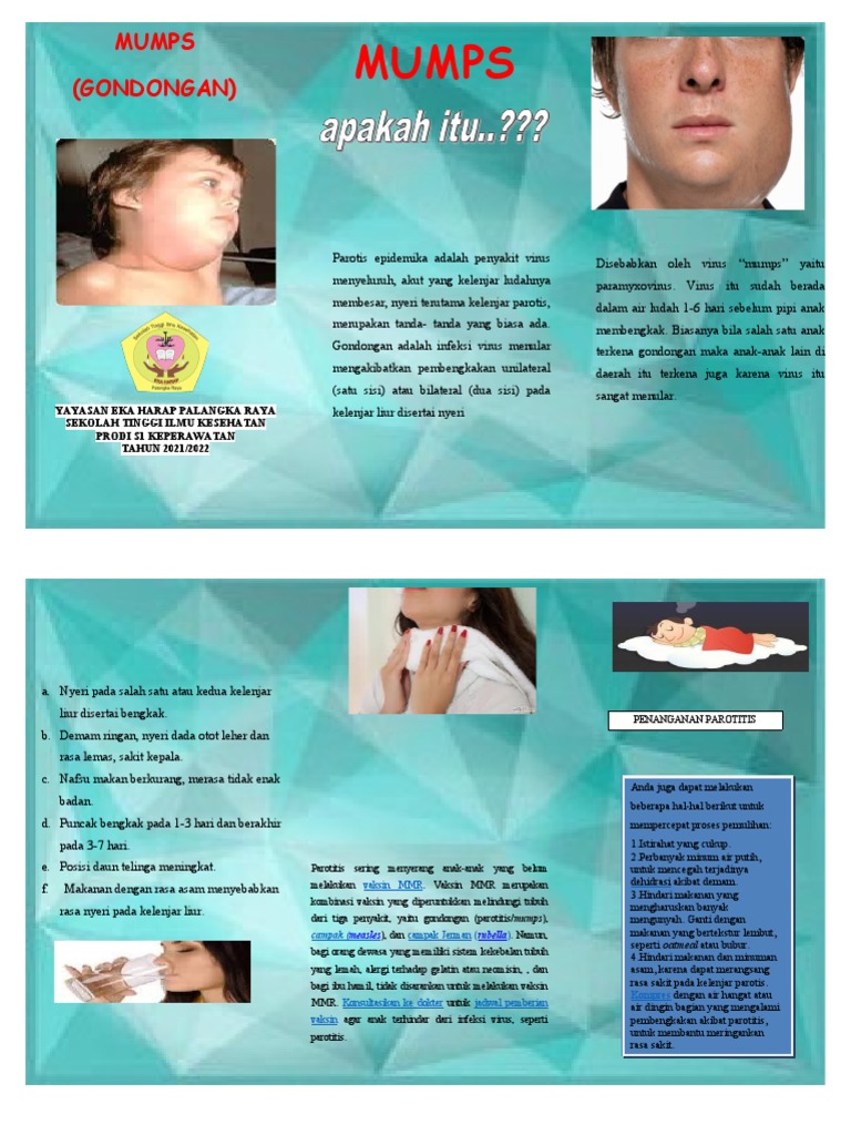 Leaflet Parotitis | PDF