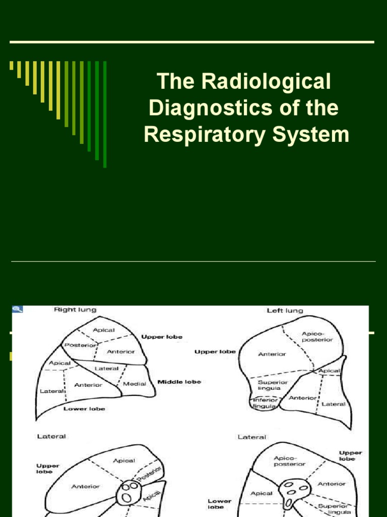 Radiological Diagnostics of Respiratory System | PDF | Radiography | Lung