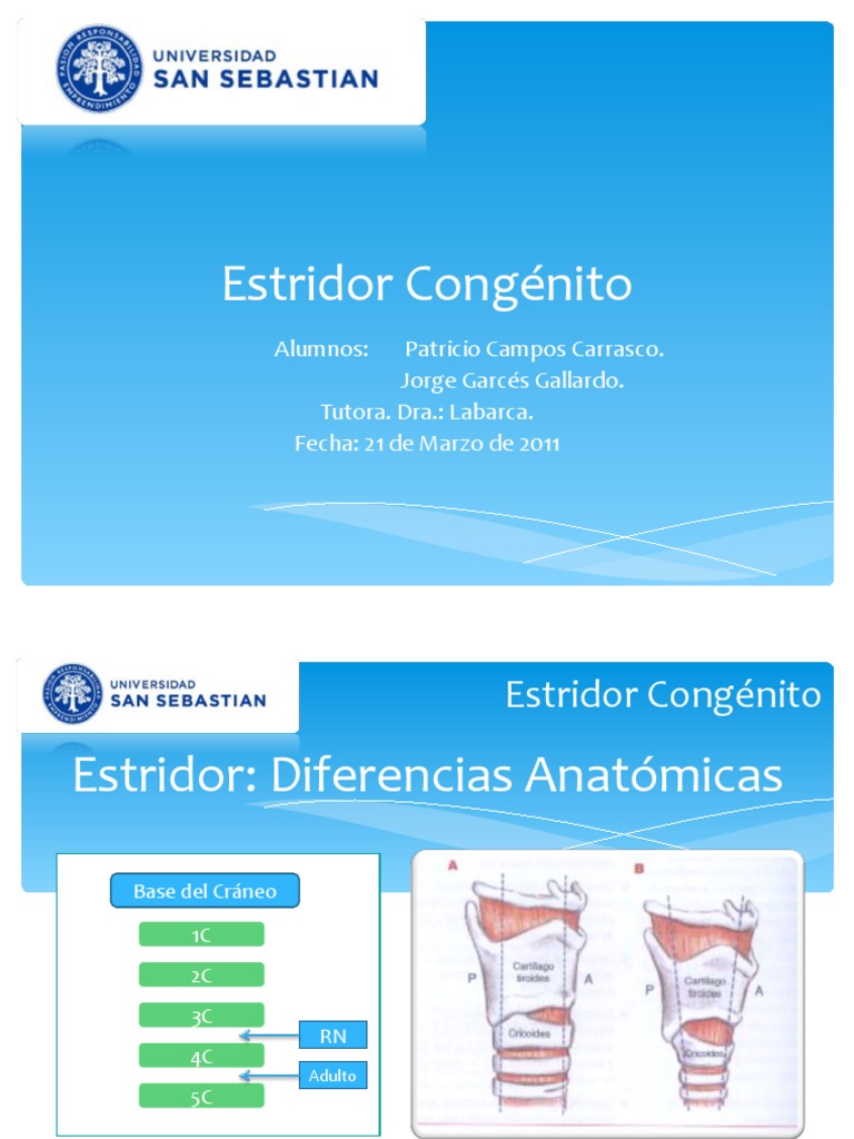 Estridor Congénito | PDF | Laringe | Medicina