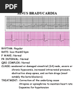 Cardiac Dysrhythmia Chart Med-Surg NUR4 | PDF | Cardiac ...