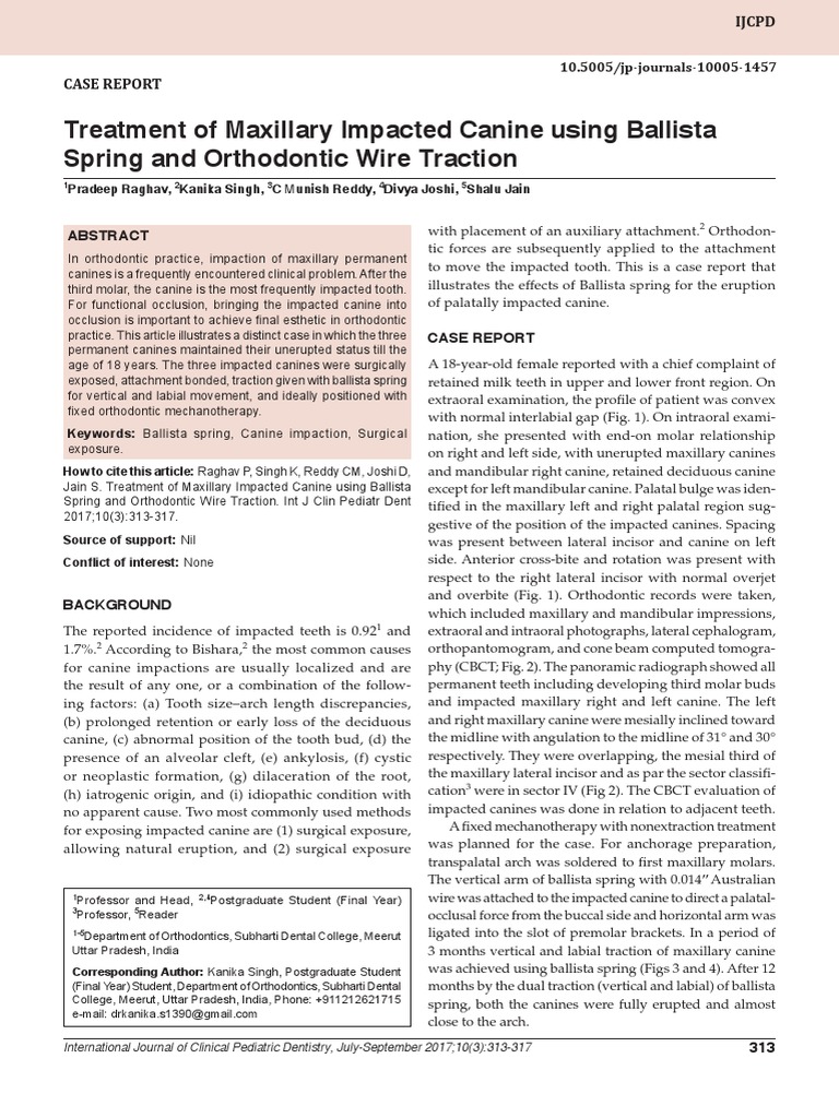 Ballista Spring for Canine Impaction Treatment | PDF | Orthodontics ...