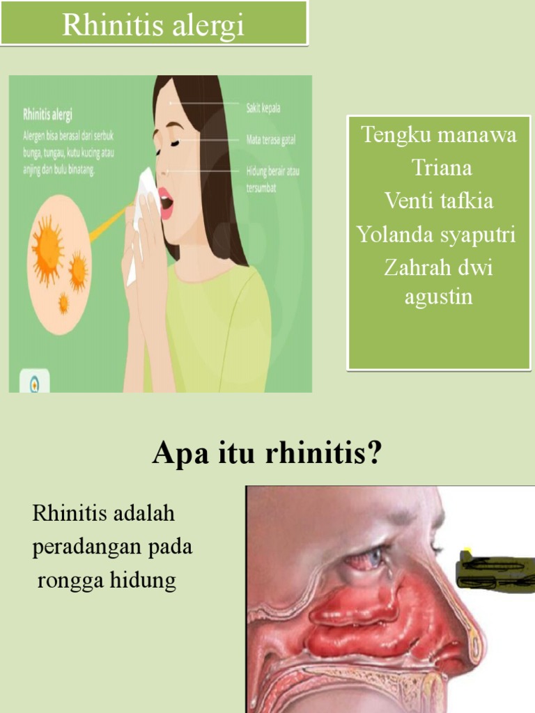 Rhinitis Alergi | PDF