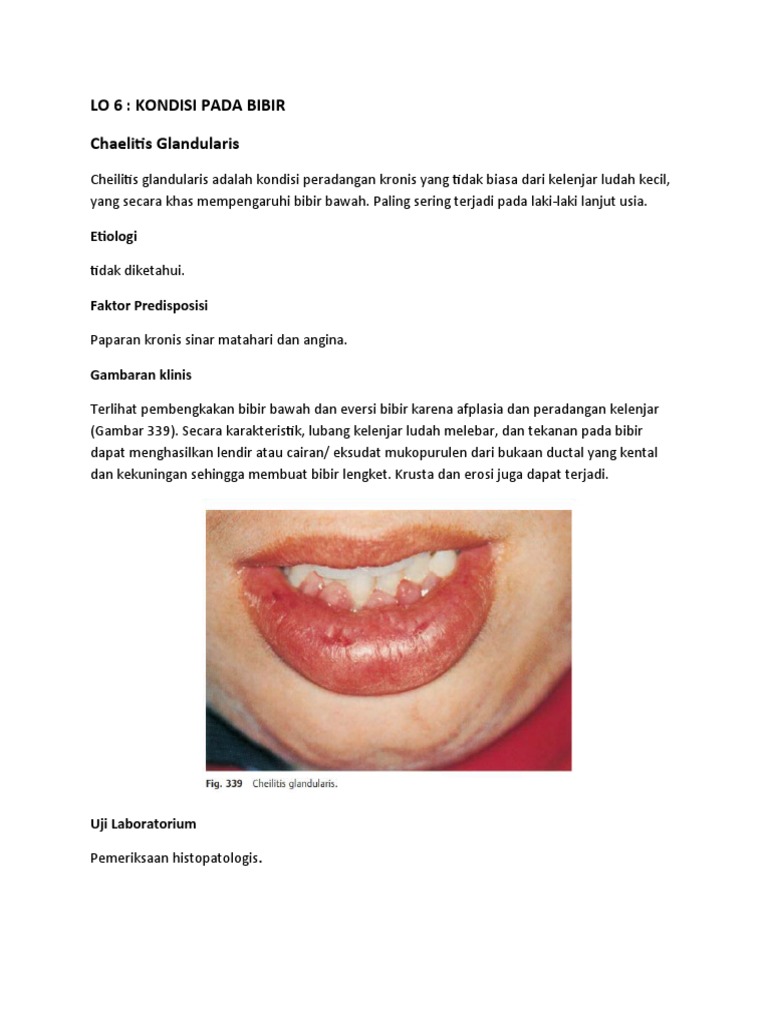 Lo 6 Modul 3 Icha | PDF