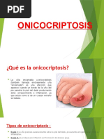Onicectomía: Procedimiento y Cuidados | PDF | Clavo (anatomía) | Dedo ...