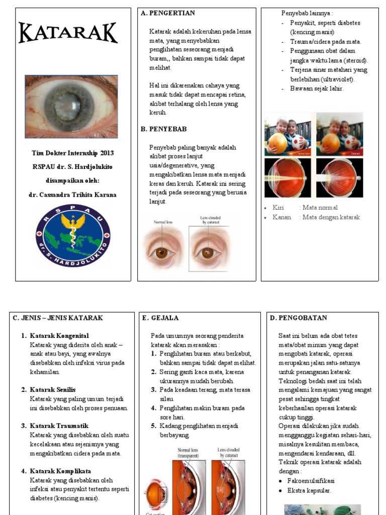 Penyuluhan Katarak Cassy | PDF