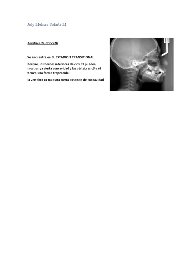 Análisis de Baccetti | PDF