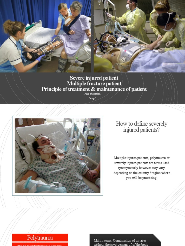 Severe Injured Patient Multiple Fracture Patient Principle of Treatment ...