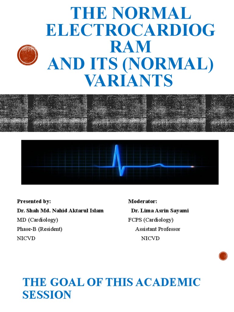 Normal Varient ECG | Download Free PDF | Electrocardiography | Cardiac ...