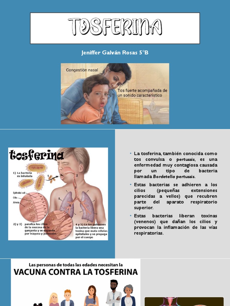 Tosferina Infografia | PDF