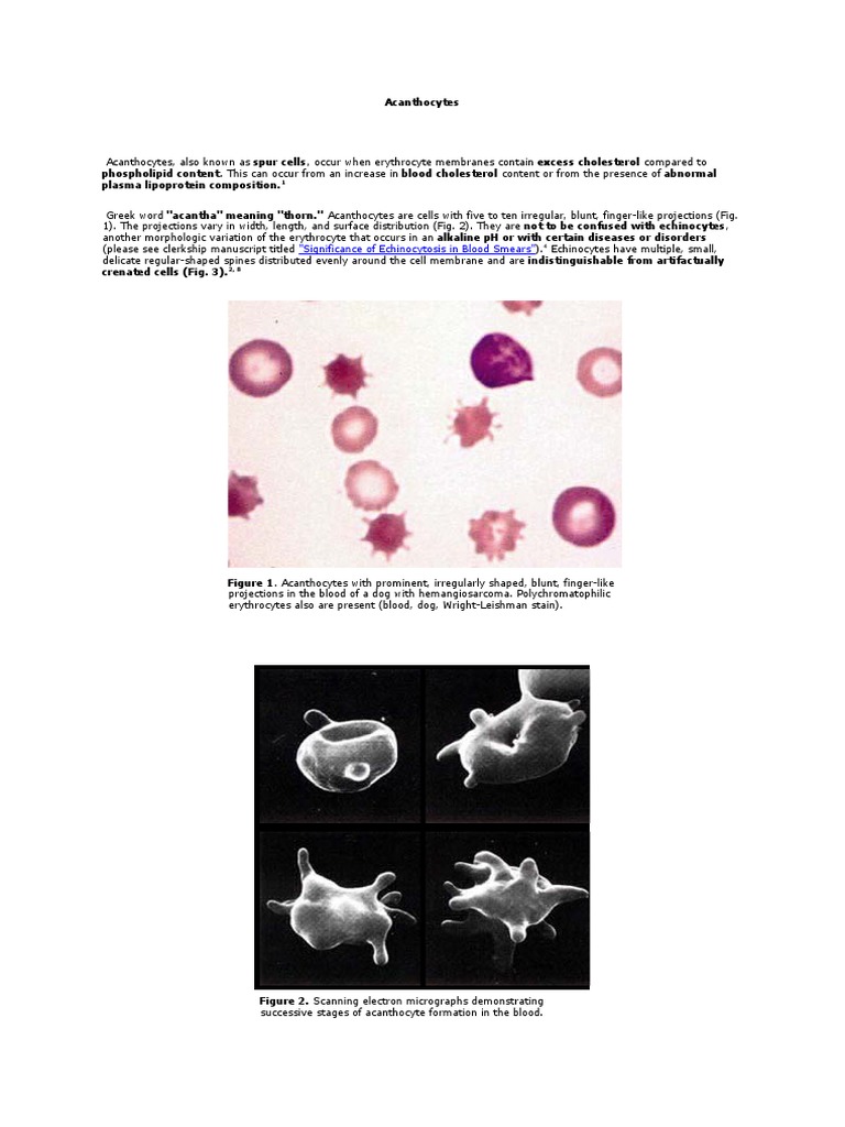 Significance of Echinocytosis in Blood Smears | PDF | Cell Biology ...