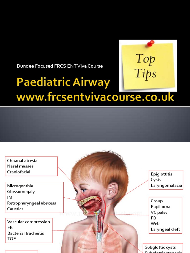 Paediatric Airway - Top Tips | PDF | Medical Specialties | Diseases And ...
