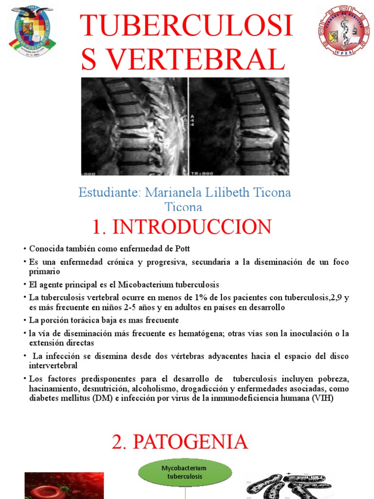 Tuberculosis Vertebral | PDF | Tuberculosis | La columna vertebral