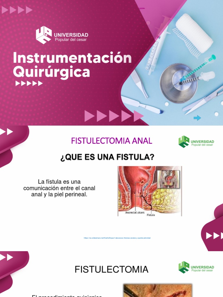 Unidad 3. Fistulectomia Anal | PDF | Cirugía | Medicina