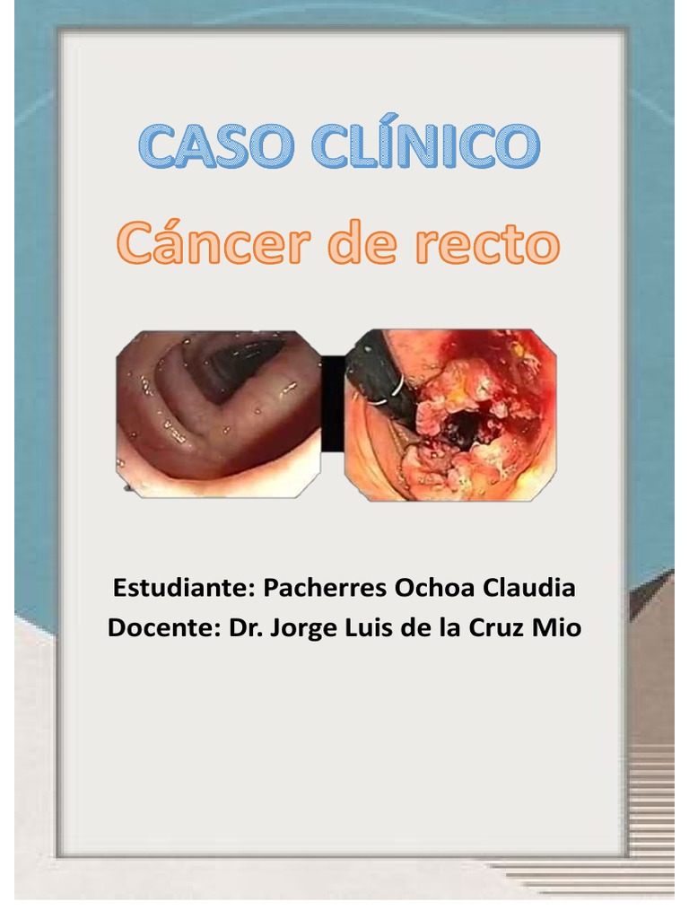 Cáncer de Recto | PDF | Cáncer colonrectal | Cáncer