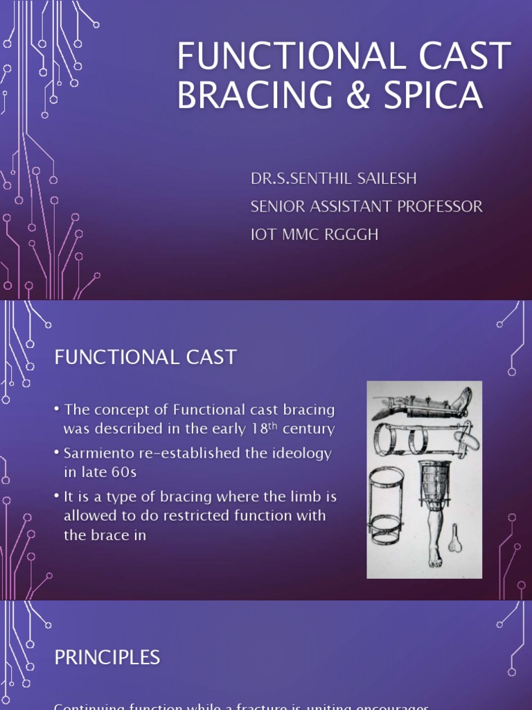 Functional Cast Bracing & Spica: Dr.S.Senthil Sailesh Senior Assistant ...