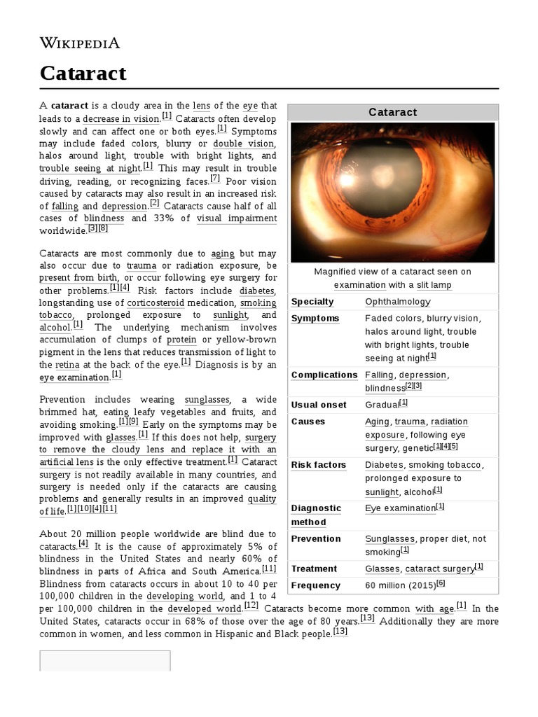 Wiki Cataract | PDF | Cataract | Clinical Medicine