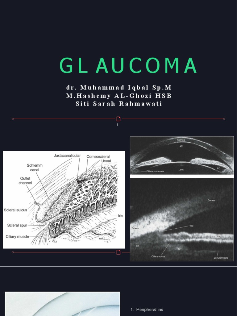 Glaucoma Pdf Glaucoma Clinical Medicine