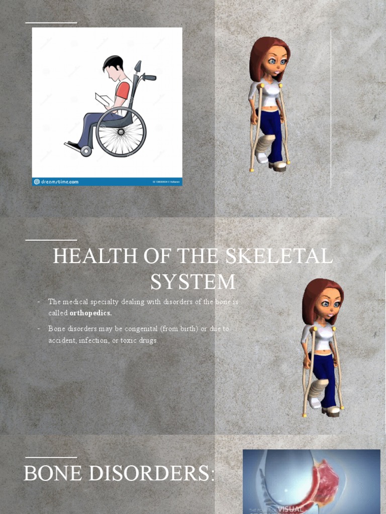 An In-Depth Look at Bone Disorders, Their Treatments, and Maintaining ...