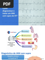 ECG - Eixo Eletrico Cardiaco 01 | PDF | Eletrocardiografia | Coração