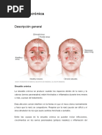 Sinusitis Aguda y Crónica | PDF | Epidemiología | Salud pública