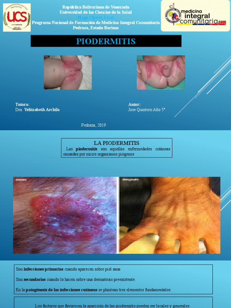 Piodermitis | PDF | Ciencias de la Salud | Medicina CLINICA