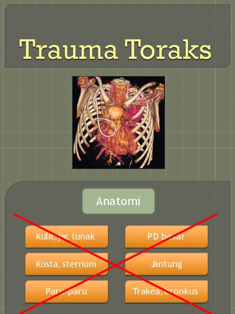 Trauma Thoraks | PDF