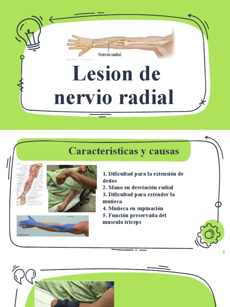 Nervio Radial Pdf – Nervio radial (anatomía, función, inervación ...