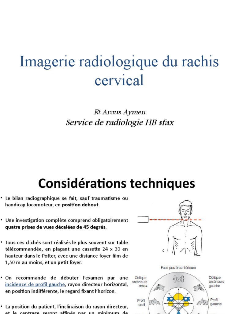 Imagerie Radiologique Du Rachis Cervical | PDF | Vertèbre | Colonne ...