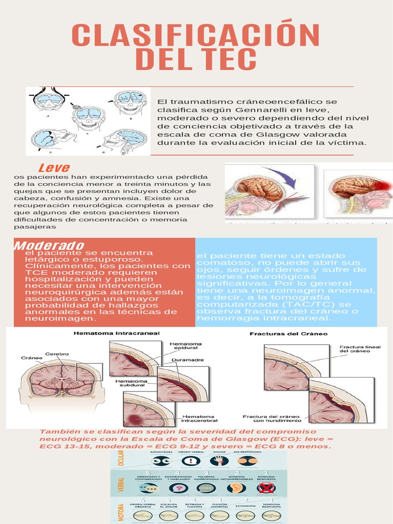 Clasificacion Tec | PDF