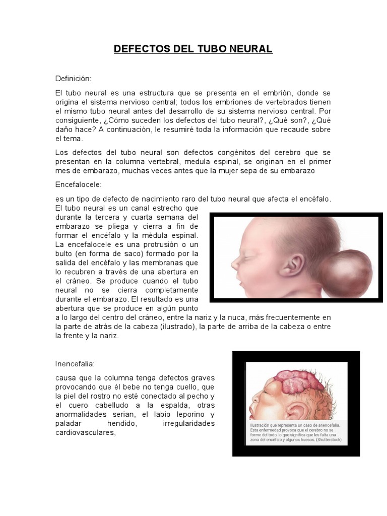 Defectos del Tubo Neural en Embarazo | PDF | Cerebro | Sistema nervioso ...