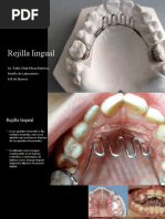 Placa Hawley | PDF | Ortodoncia | Odontología