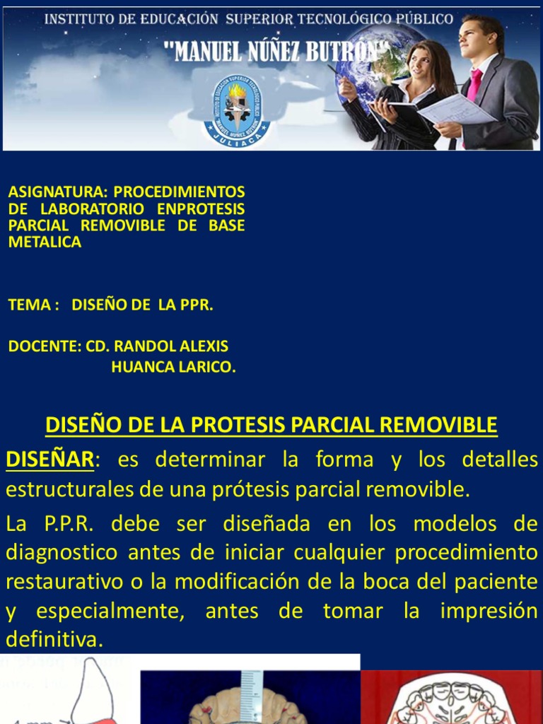 Diseño de PPR | PDF | Dentadura postiza | Boca