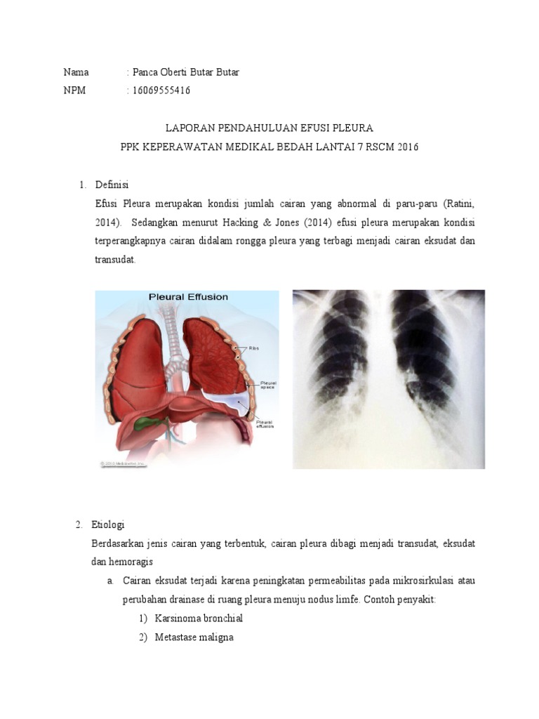 LP Efusi Pleura | PDF