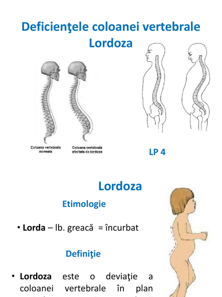 2 Lordoza | PDF