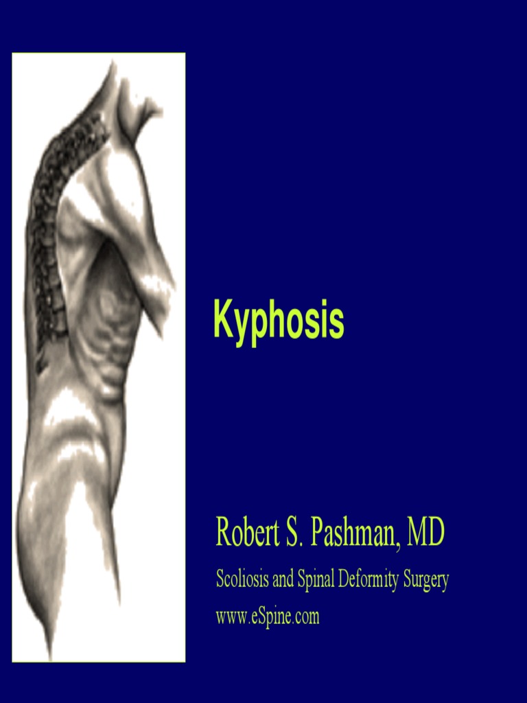 Kyphosis Lordosis Defined This Drawing Represents The Spinal Condition ...