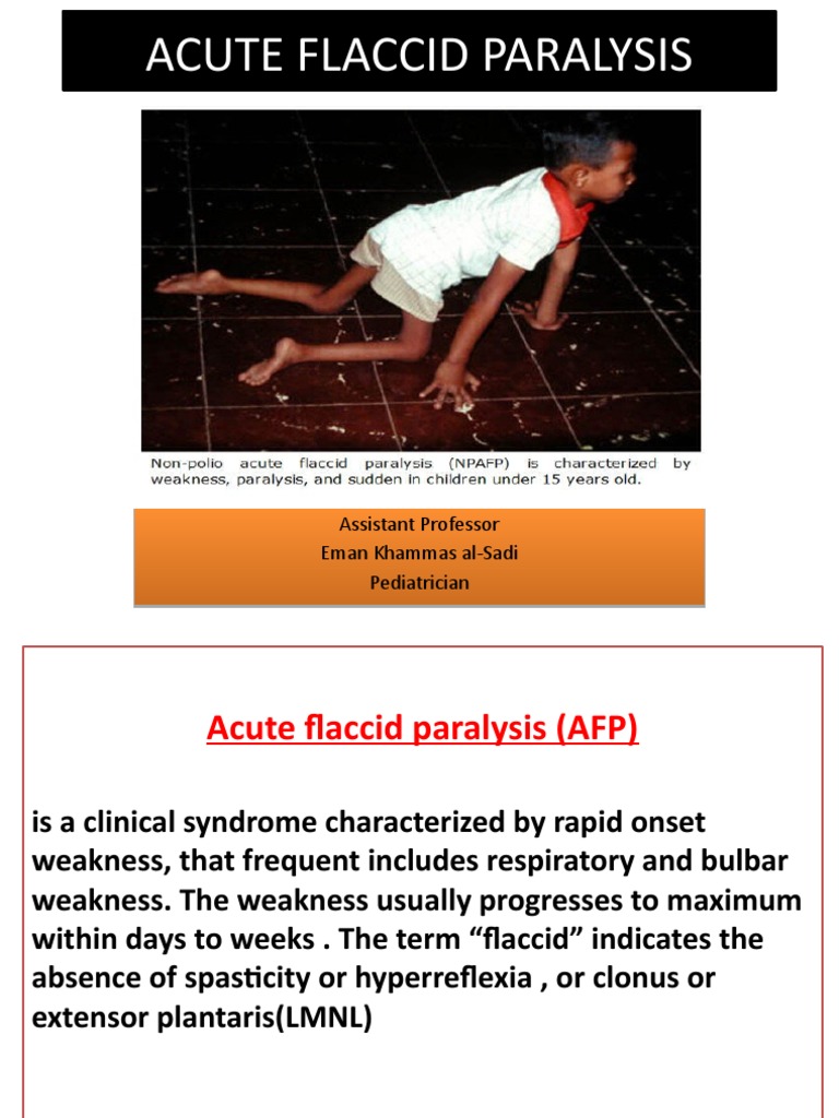 Acute Flacid Paralysis Approach | PDF | Epidemiology | Nervous System