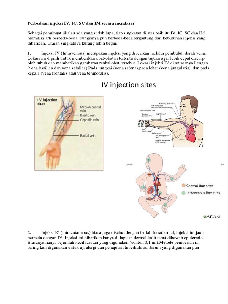 Perbedaan Injeksi IV Ic SC Dan Im Secara Mendasar PDF Free | PDF