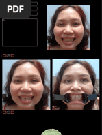 DSD Template PowerPoint | PDF