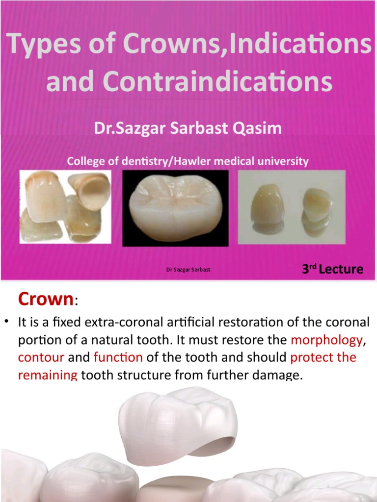 3rd Lec. Types of Crowns, Indications and Contraindications | PDF ...