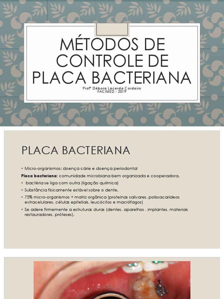 Métodos de Controle de Placa Bacteriana | PDF | Odontologia | Boca